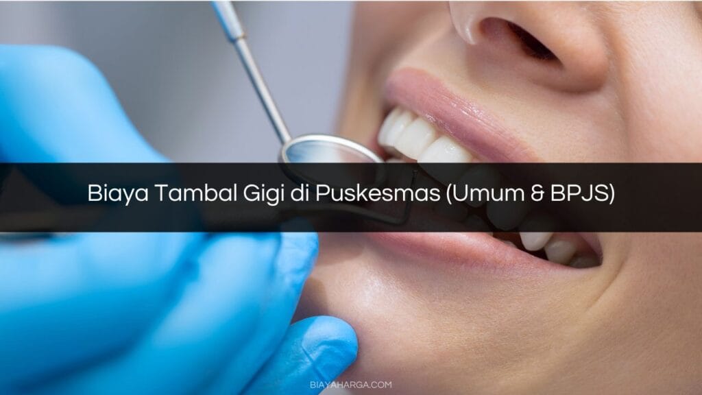√ Biaya Tambal Gigi di Puskesmas (Umum & BPJS) 2023 – Harga Biaya