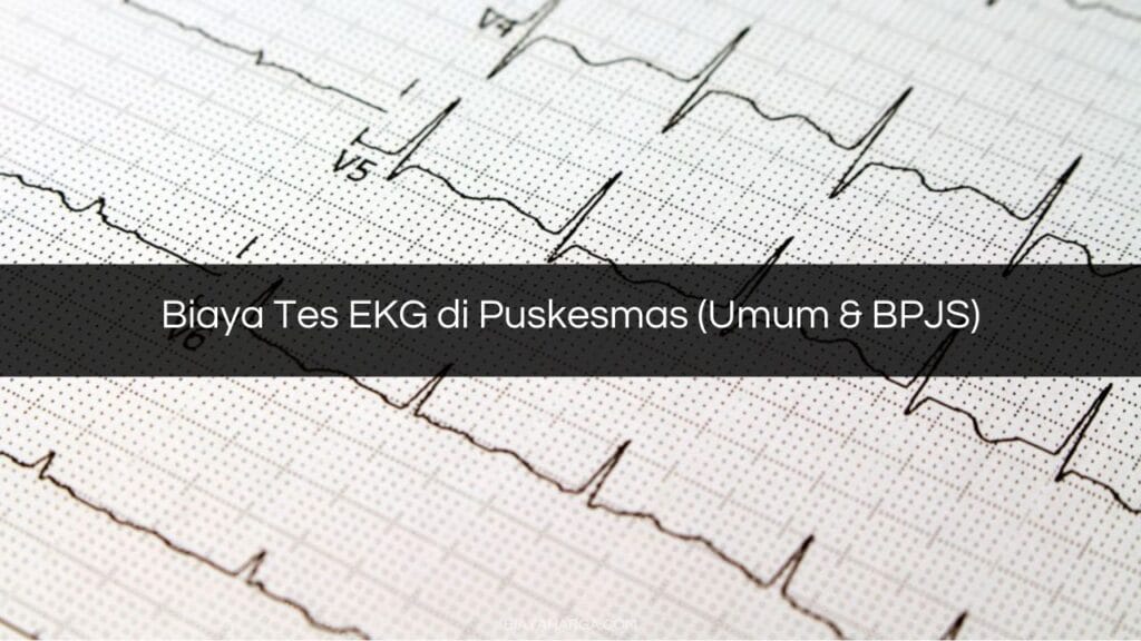 √ Biaya Tes EKG di Puskesmas (Umum & BPJS) 2023 – Harga Biaya