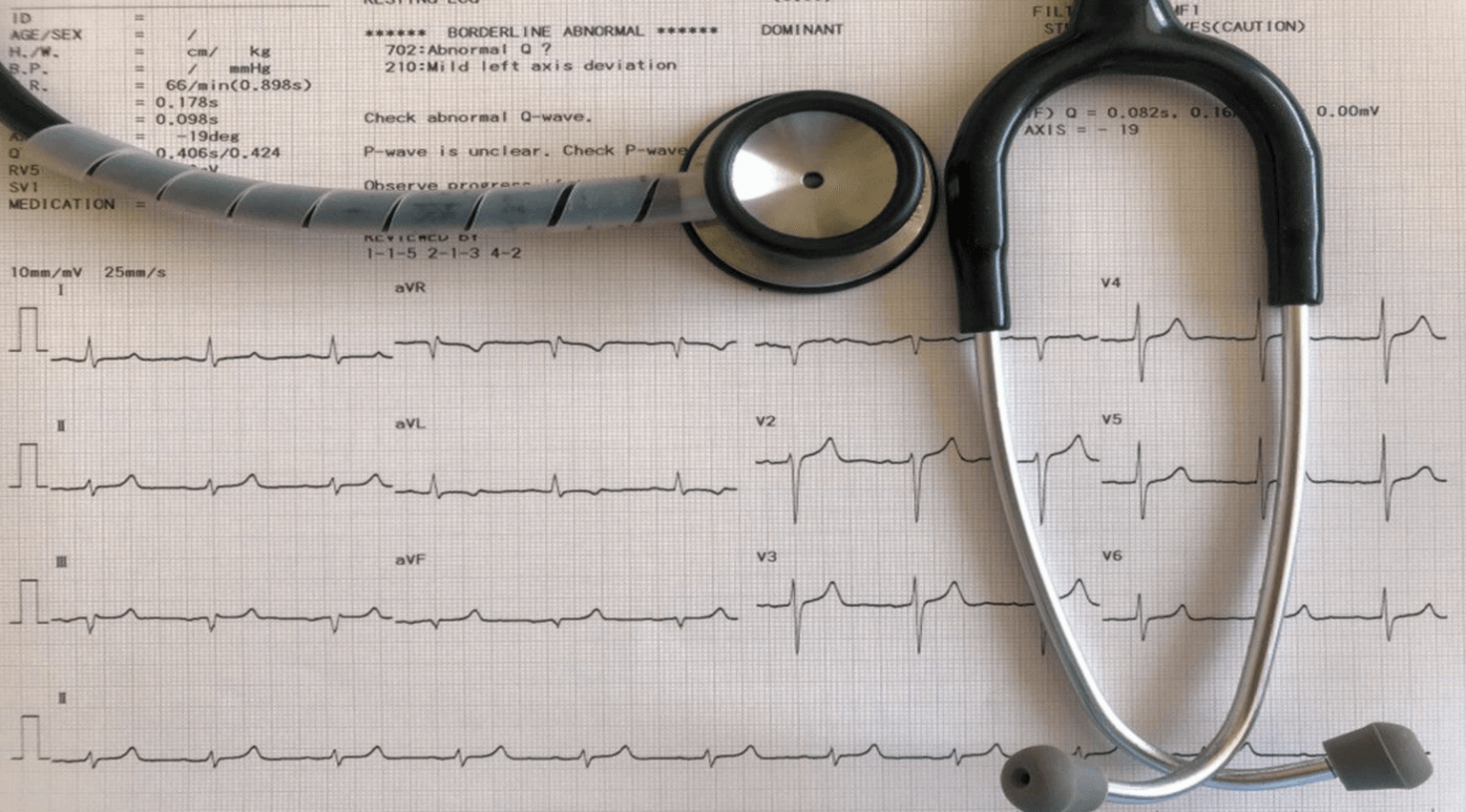 √ Biaya Tes EKG di Puskesmas (Umum & BPJS) 2023 – Harga Biaya