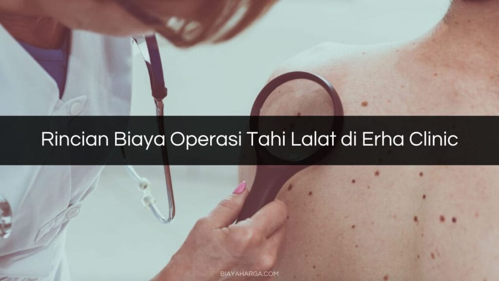 √ Rincian Biaya Operasi Tahi Lalat di Erha Clinic 2023 – Harga Biaya