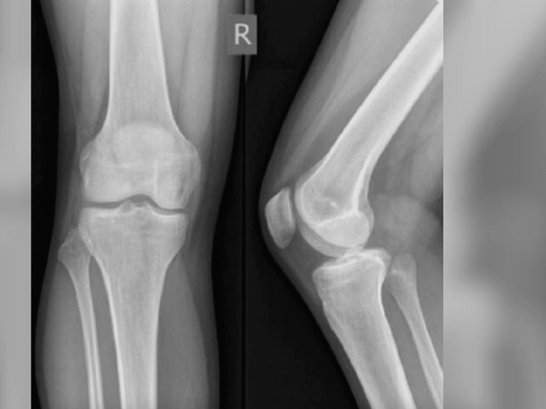 √ Prosedur & Biaya Rontgen Kaki di Klinik Prodia 2023 – Harga Biaya