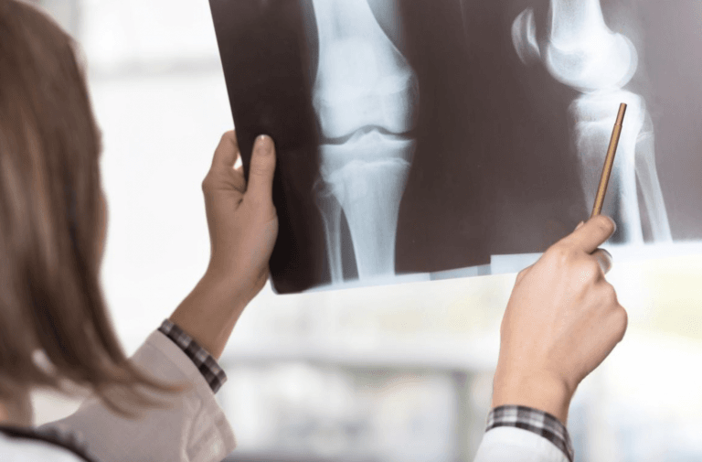 √ Biaya Rontgen Tangan di RS, Klinik & Puskesmas 2023 – Harga Biaya