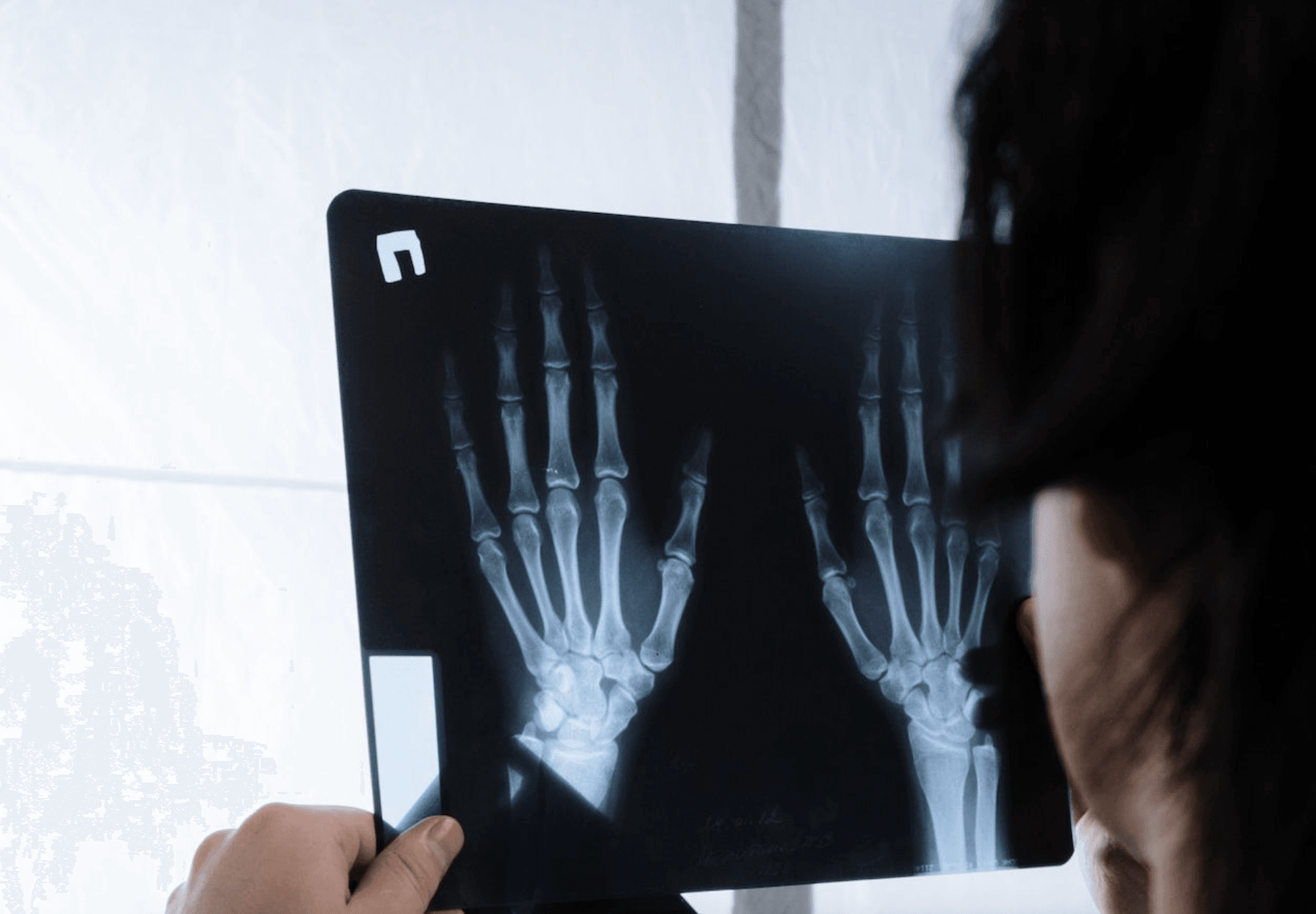 √ Biaya Rontgen Tangan di RS, Klinik & Puskesmas 2023 – Harga Biaya