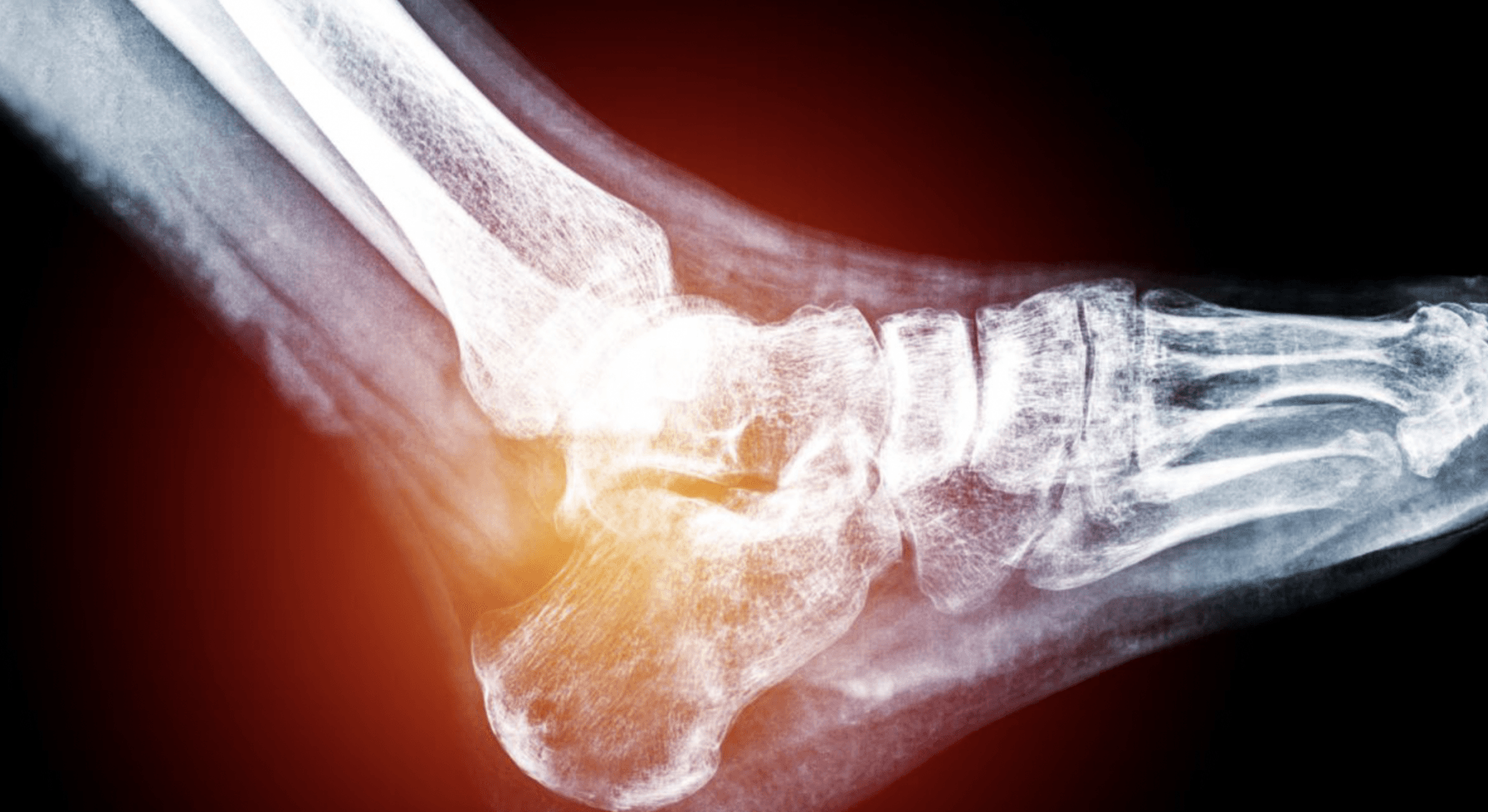 √ Prosedur & Biaya Rontgen Kaki di Klinik Prodia 2023 – Harga Biaya