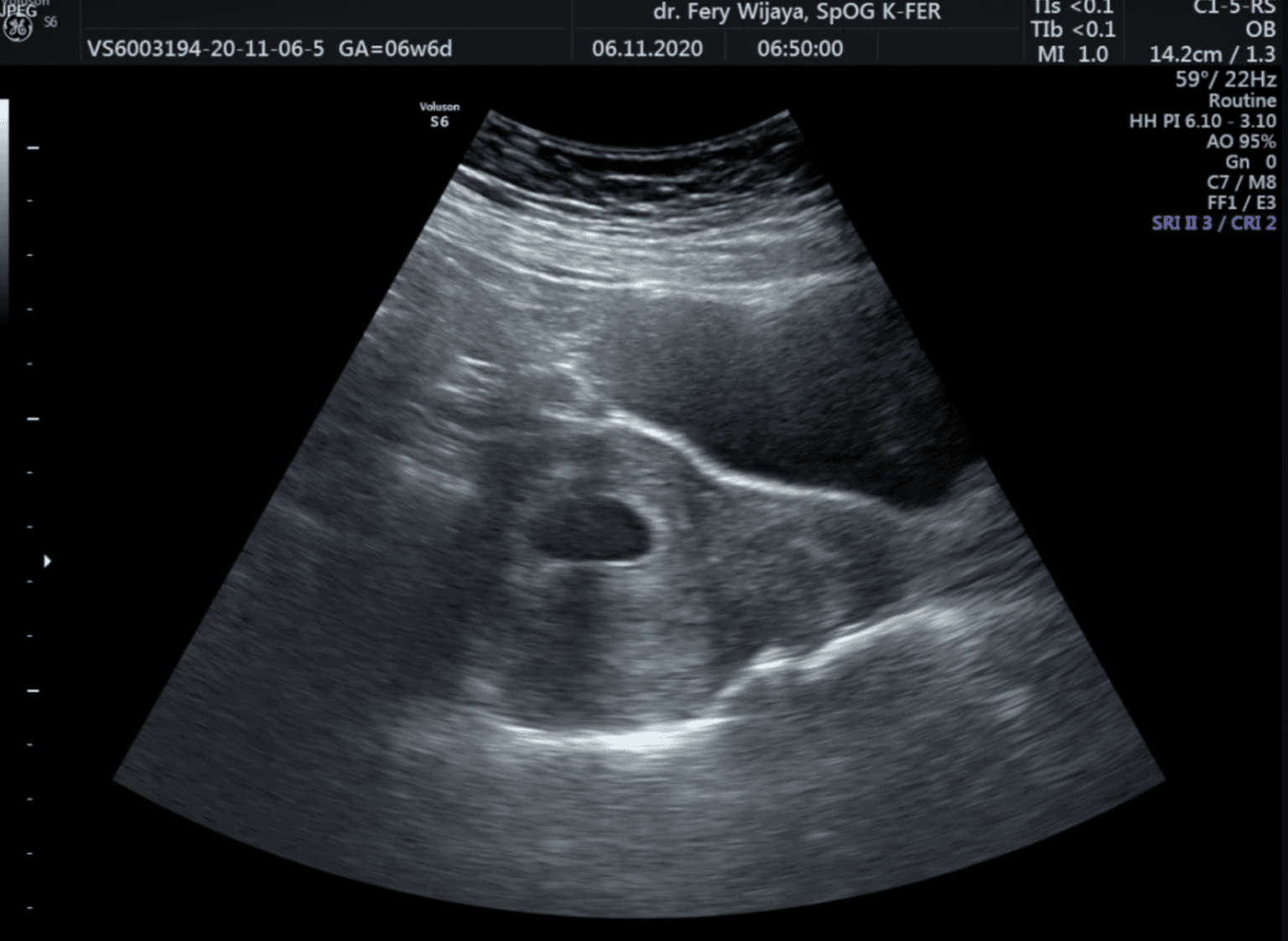 √ Biaya USG Perut di Kalinik Prodia 2023 – Harga Biaya