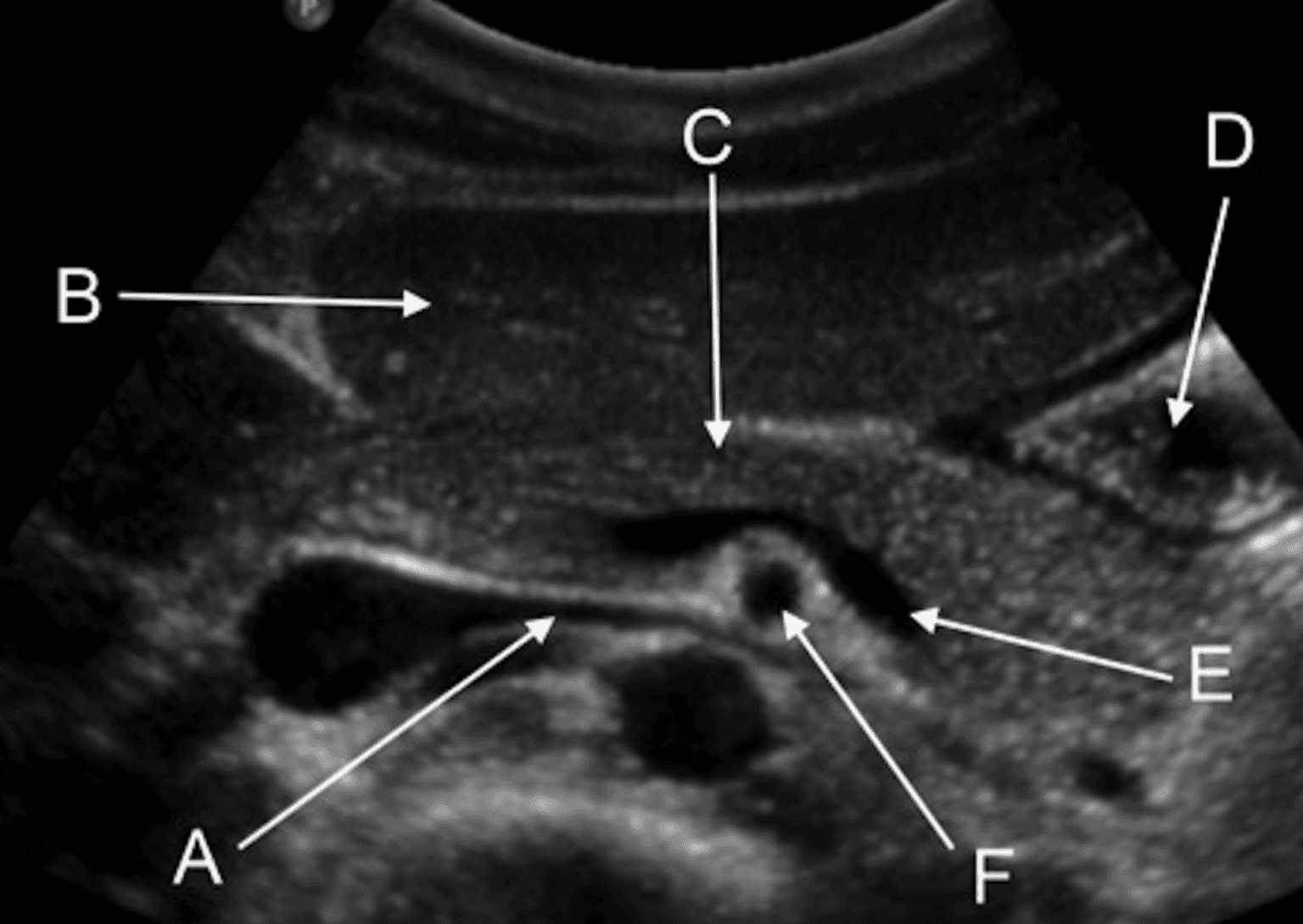 √ Prosedur & Biaya USG Abdomen di Lab Pramita 2023 – Harga Biaya