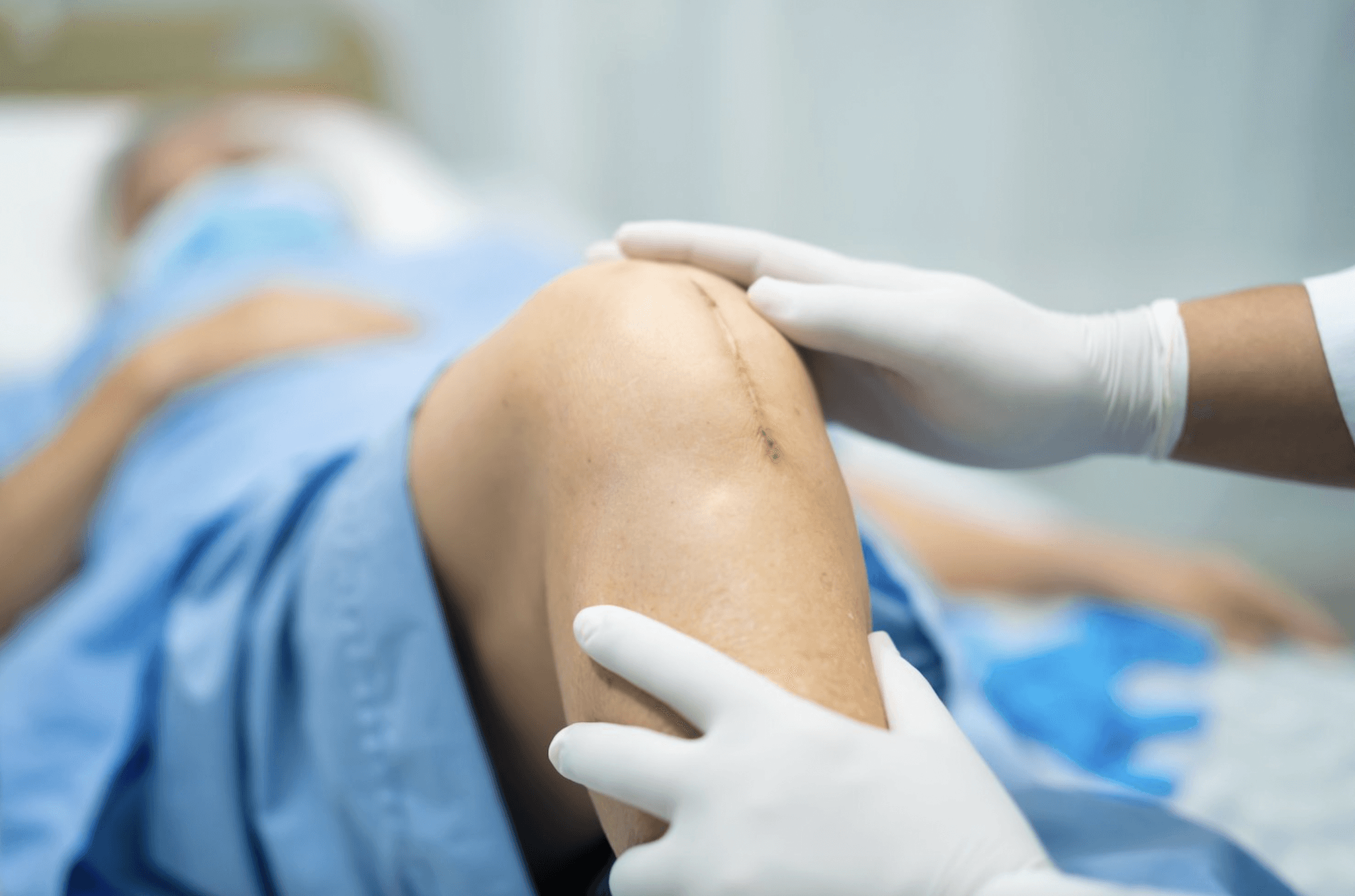 √ 7 Biaya Jahit Luka di Puskesmas : Manfaat, Indikasi, Prosedur – Harga ...