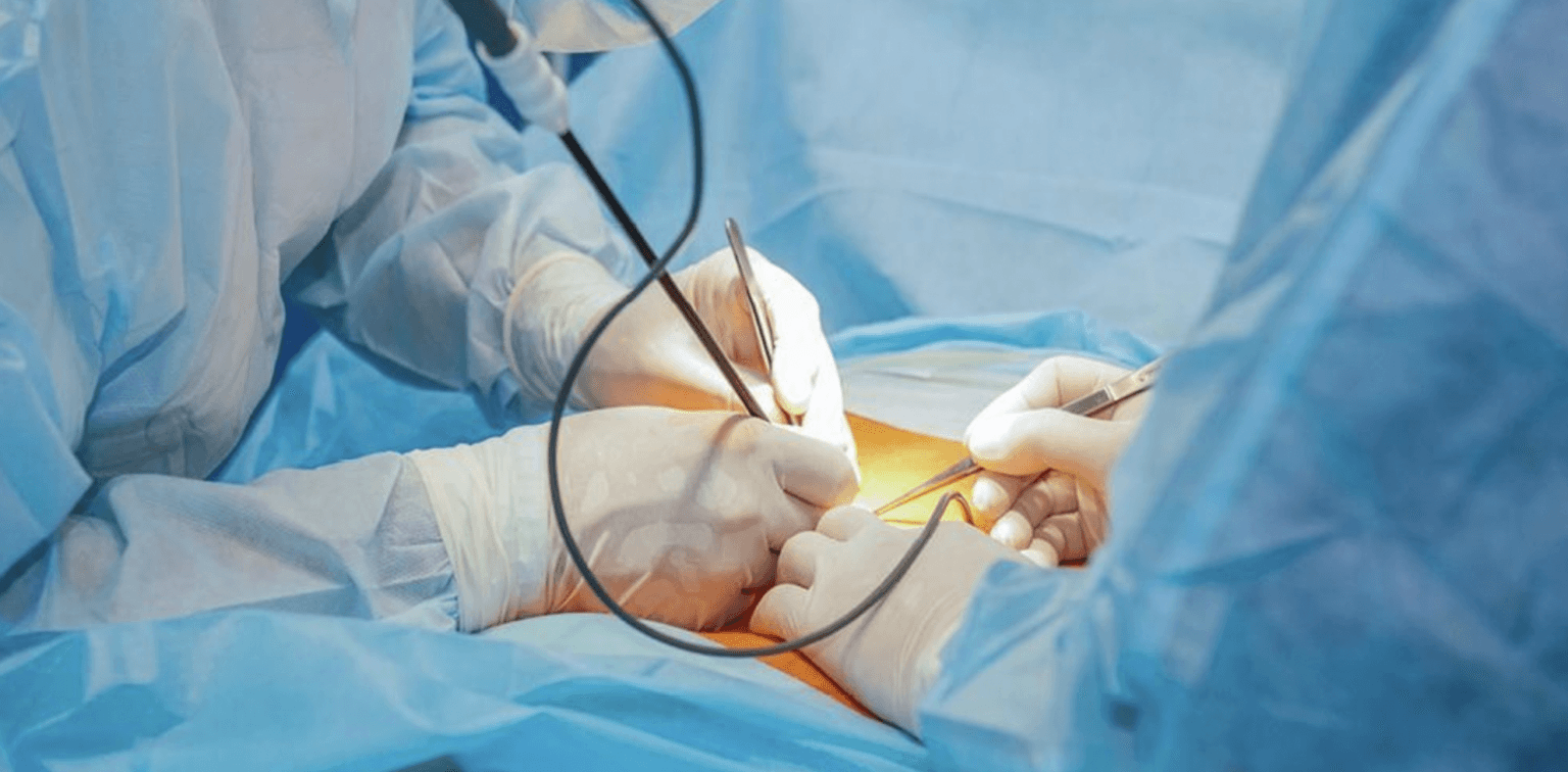 √ 2 Biaya Operasi Kista Ovarium 2023 : Pasien Umum & BPJS – Harga Biaya