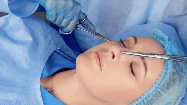 √ Biaya Operasi Polip Hidung 2023 : Pasien Umum & BPJS – Harga Biaya