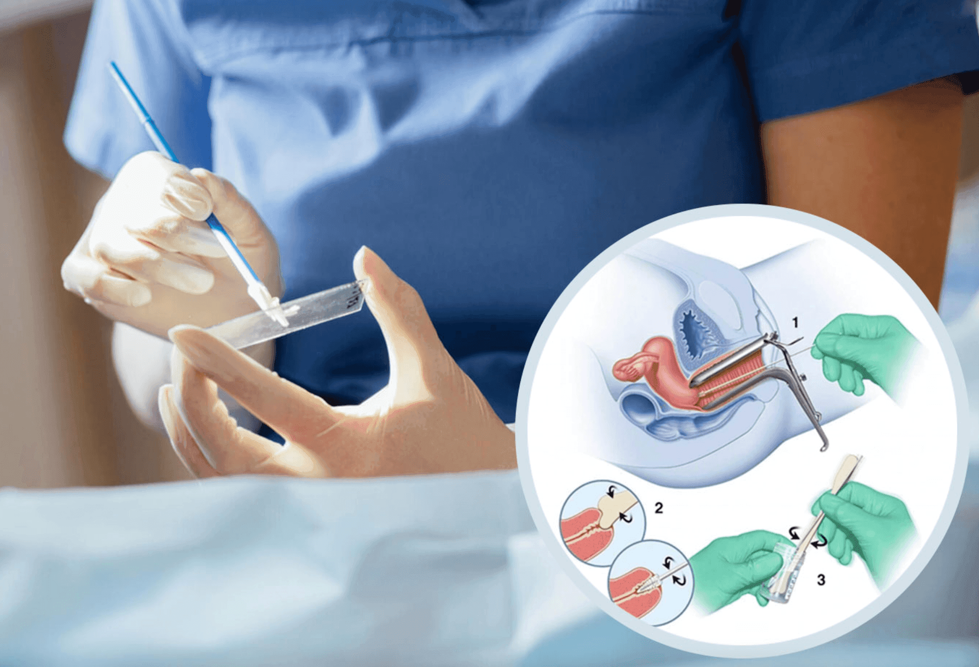 √ Biaya Pap Smear di Lab Pramita 2023 : Indikasi & Prosedur – Harga Biaya