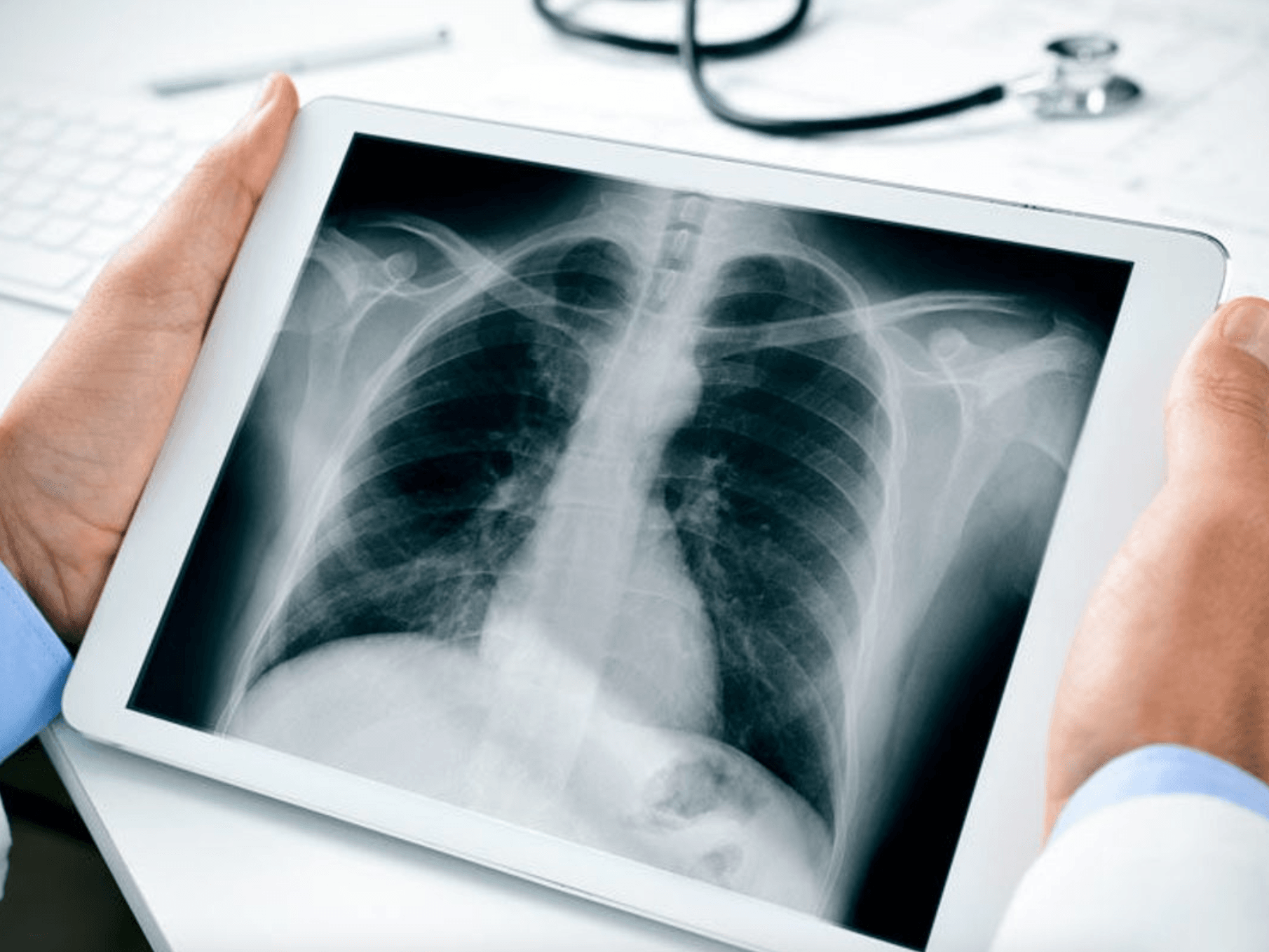 в љ Biaya Rontgen Di Kimia Farma 2023 Prosedur Efek Samping вђ Harga Biaya