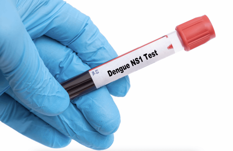 √ 2 Biaya Cek Darah DBD di Prodia 2023 : Gejala & Prosedur – Harga Biaya